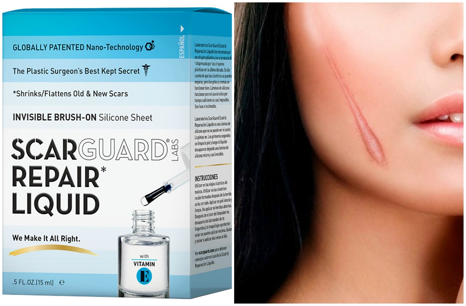 REVIEW GEL TRỊ SẸO SCARGUARD REPAIR LIQUID (SCARGUARD MD) | nzheal.com
